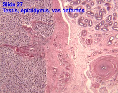 Labeled Epididymis Microscope Slide